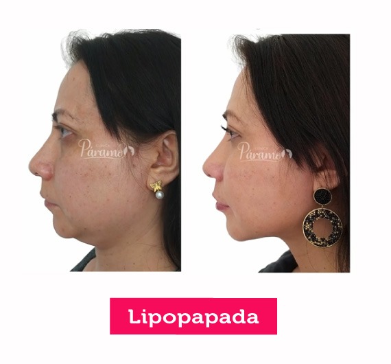 Clínica Páramo | Especialistas en estética facial y dental